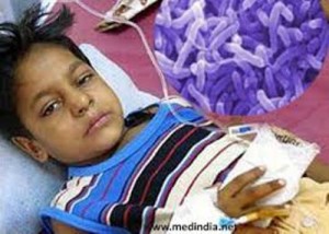 10 Interesting Cholera Facts | My Interesting Facts